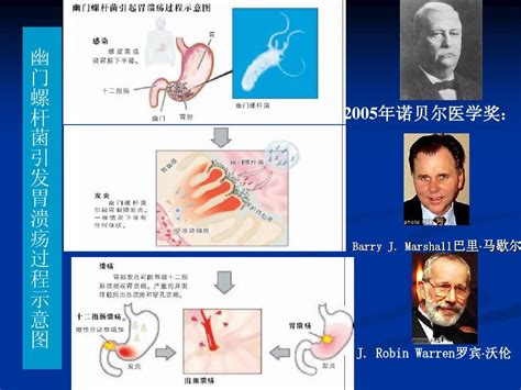 消化性溃疡word文档在线阅读与下载无忧文档