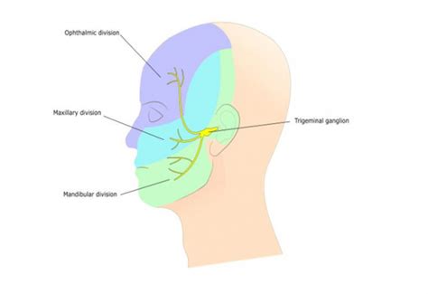 Botulinum Toxin Botox For Trigeminal Neuralgia Wilderman Clinic