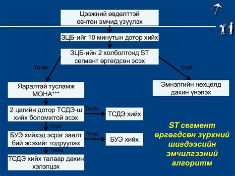 New зүрхний шигдээс