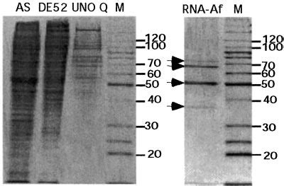 Purification Of CSBP II Protein Samples From Different Stages Of CSBP Download Scientific