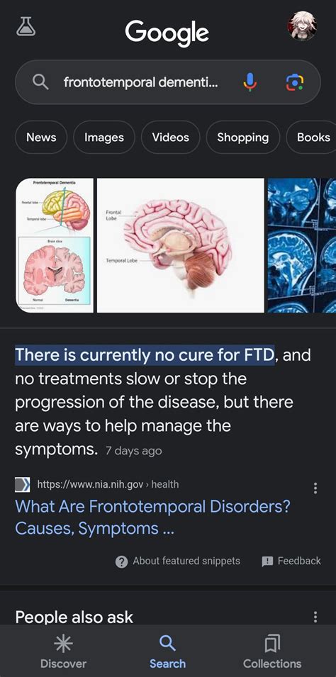 Did Some Research Into Nagitos Conditions And It All Makes Perfect