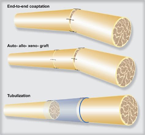 1 The Most Currently Used Microsurgical Techniques In Experimental And Download Scientific