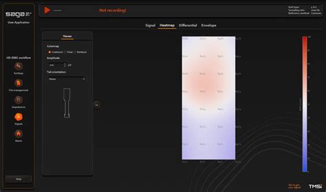 Tmsi — An Artinis Company — Saga User Application