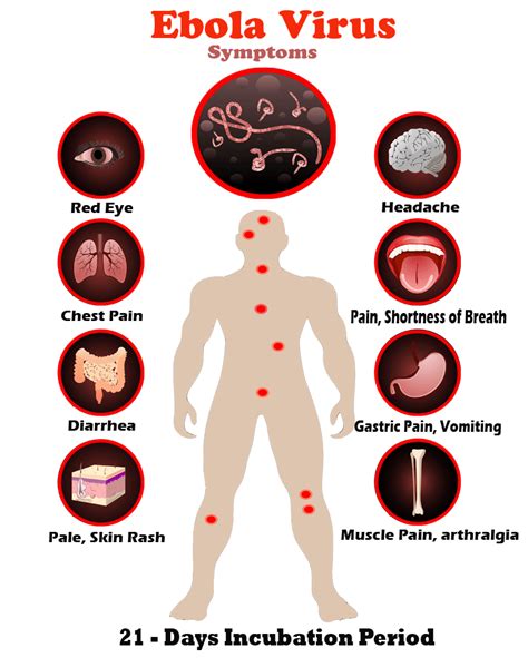 Ebola Virus Symptoms Rash
