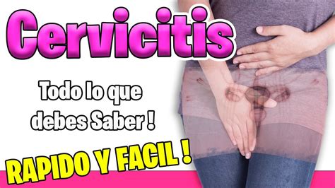 Cervicitis Causas Sintomas Y Tratamiento Youtube
