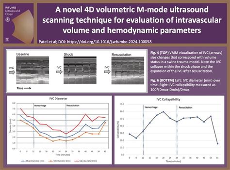 Novel Ultrasound Intravascular Hemodynamic 4d Ivc Wfumb Ultrasound Open
