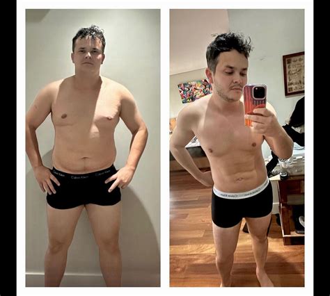 Foto Matheus Da Dupla Kauan Se Submeteu A Uma Lipo HD Purepeople