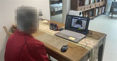 콜린알포 치매만 건보 유지뇌질환 150만명 부담 커진다
