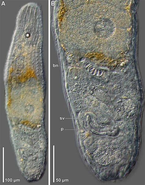 Figure 22 Genus 1 Species 1 In Acoela Acoelomorpha From The Northern