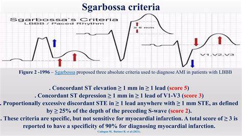 Sgarbossa Criteria In Left Bundle Branch Block In A Hypertensive Emergency A Case Report Dr