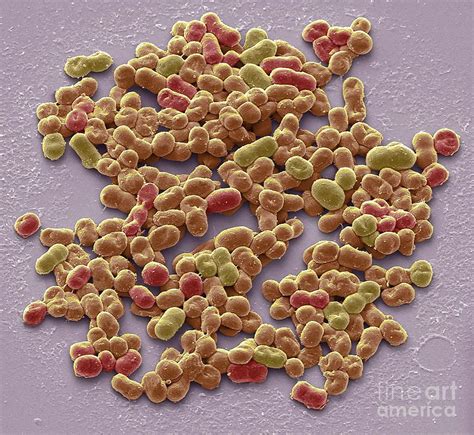 Azotobacter Chroococcum 1 Photograph By Steve Gschmeissnerscience Photo Library Fine Art America