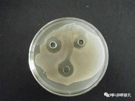 干货分享 一文了解抑菌圈试验 知乎