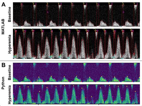 Images Displaying The Removal Of Top Noise From Analysis In The Updated Download Scientific