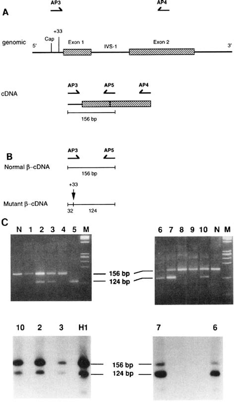 Figure 1 From Moderate Reduction Of Beta Globin Gene Transcript By A