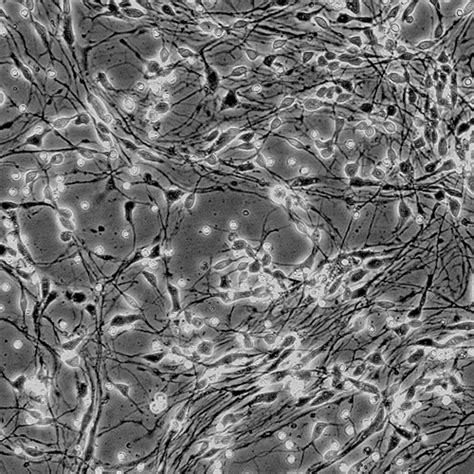 Human Hippocampal Neurons Innoprot Brain Cell System