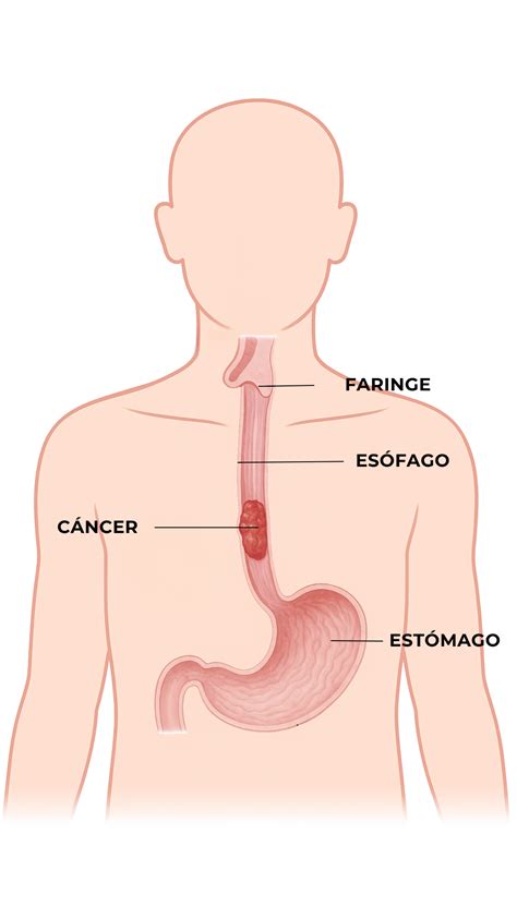 Oncoclinic Tu Aliado En La Lucha Contra El Cáncer Oncoclinic Bolivia