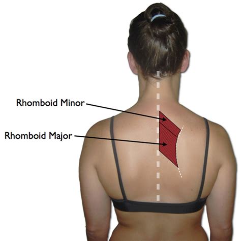 Rhomboid Pain