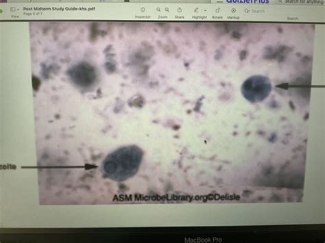 Pathogenic Eukaryotes Study Set For Biology Students Flashcards Quizlet