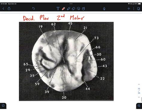decid max 2nd molar anatomy quiz