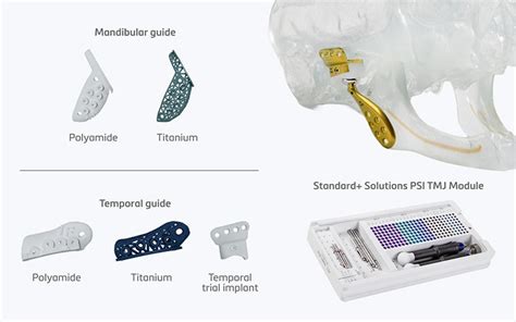 Tmj Total Arthroplasty Personalized Implants And Guides
