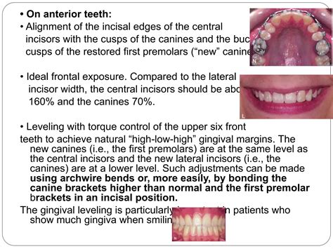 Congenital Missing Maxillary Lateral Incisors Pptx