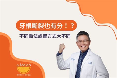 牙根斷裂也有分！？不同斷法處置方式大不同 林錫奎牙醫師 台北牙醫推薦 假牙專家打造堅固的美齒