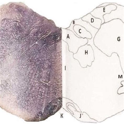 Coronal Section Of The Medulla Oblongata At Level Of Pyramidal