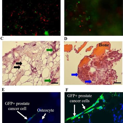 Ex Vivo Human Bonetumor Cell Niche Viable Enhanced Green Fluorescent