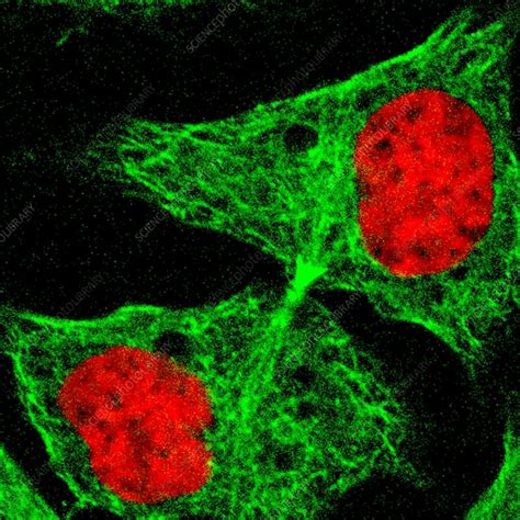 Human Cell Early In Cytokinesis Light Micrograph Stock Image C056