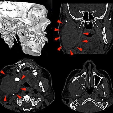 Multi Slice Computed Tomography A 3 Dimensional Reconstruction Image