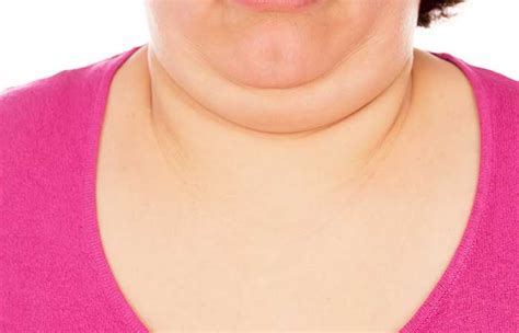 Cara Menghilangkan Lemak Di Leher Double Chin