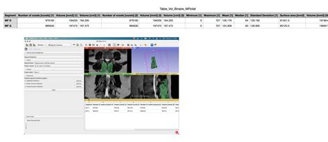 Classify Voxels Via A Predefined Threshold Support 3d Slicer Community