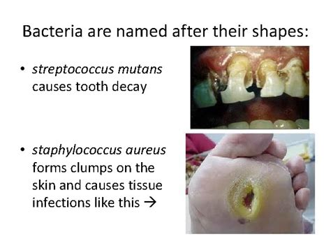 Bacteria Bacteria Is Small Single Living Organism Prokaryote