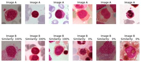 Automated Bone Marrow Cell Classification For Haematological Disease Diagnosis Using Siamese