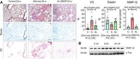 Ac SDKP Attenuates Activation Of Lung Macrophages And Bone Osteoclasts