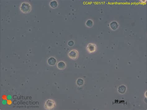 Acanthamoeba Polyphaga