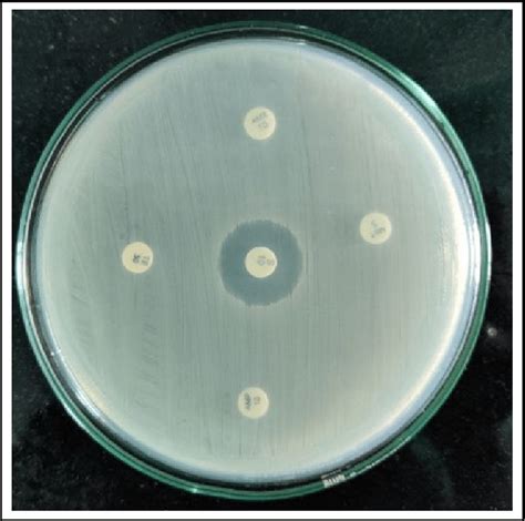 Antibiotic Susceptibility Of The Escherichia Coli Download Scientific Diagram