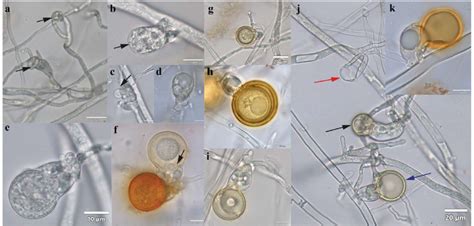 Sexual Morphogenesis In Phytophthora Palmivora Uq3694 A1 And Uq3746