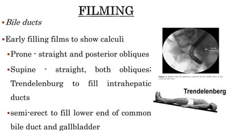 Ercp Cholangiopancreatography Bile Ducts Procedure Pptx Digestive Disorders Diseases And