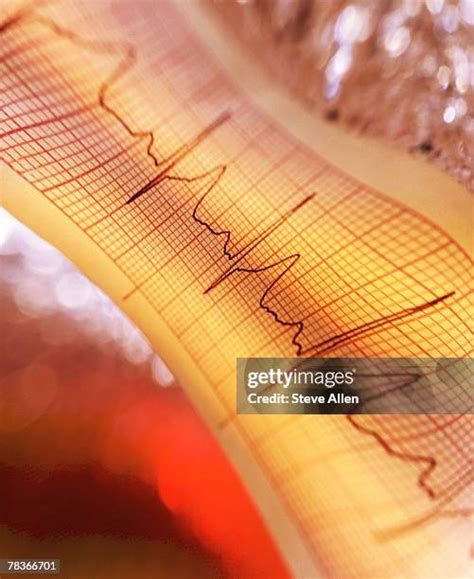 Ecg Grid Photos And Premium High Res Pictures Getty Images