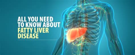 All You Need To Know About Fatty Liver Disease Kdah Blog Health And Fitness Tips For Healthy Life