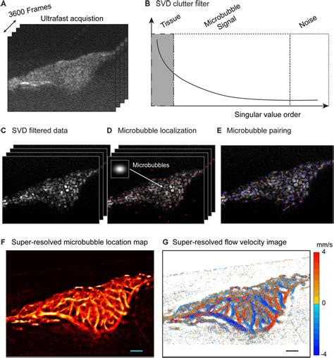 Microbubble Localization And Tracking A Iq Data 3600 Frames Was