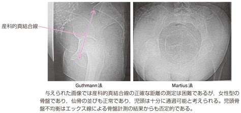 116c50 胎勢の異常 国試 M3e Medical