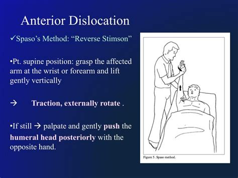 Ppt Shoulder Dislocation Powerpoint Presentation Id4841498