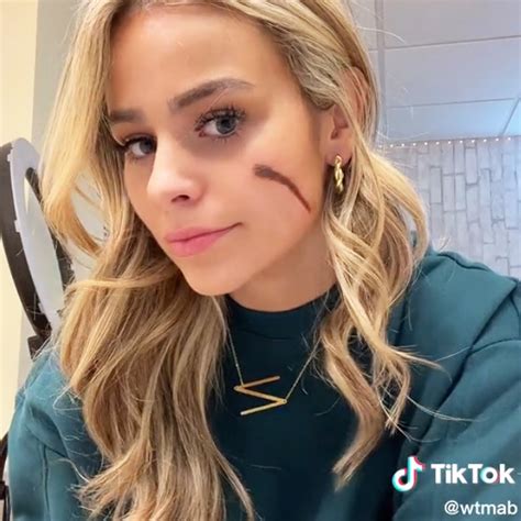 Tiktoks Scar Girl Annie Bonelli Reacts To Claims Her Scar Is Fake