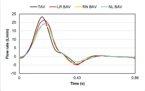 Flow Rate Waveforms Generated By The Left Heart Simulator With The Download Scientific