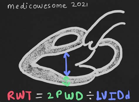 Medicowesome Relative Wall Thickness On Echocardiography