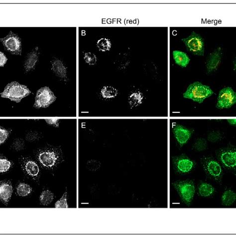 Dephosphorylation Of An Endosomal Pool Of Ptdins3p By Mtms Hela Cells