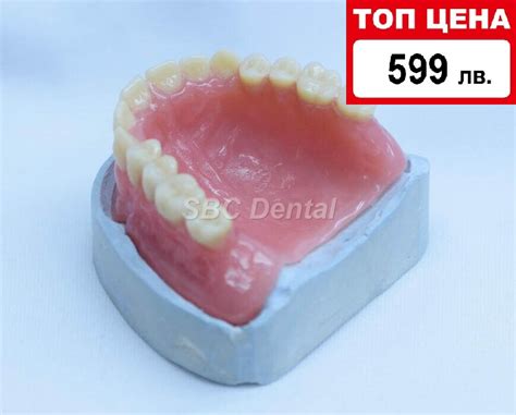 Еластични силиконови меки протези Thermosens Дентален център Ес Би Си