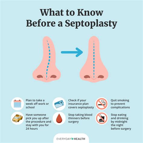 Septoplasty